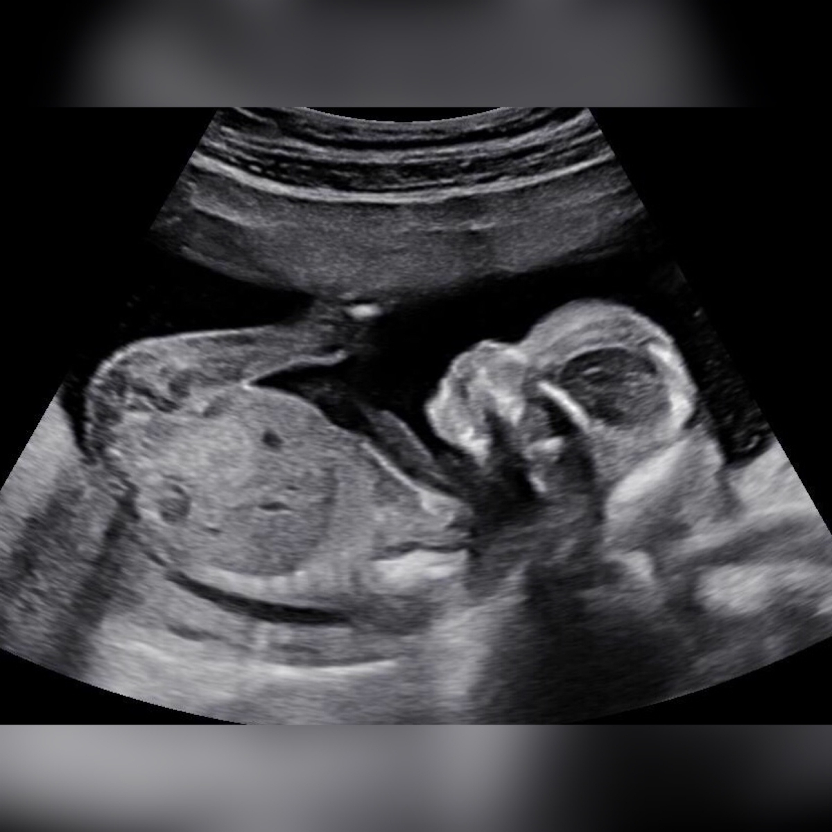 2D, 3D en 4D Pretecho's | Pretecho Vol Verwachting Cuijk, Mill en Uden