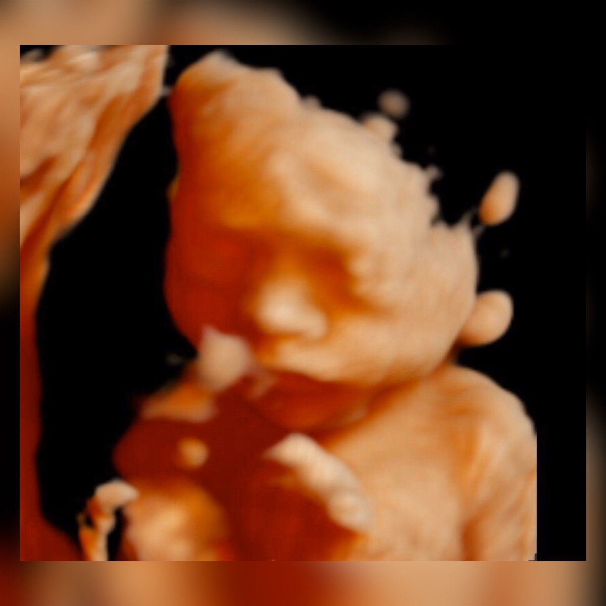 3D echo Pretecho Vol Verwachting voorbeeld 3 | Pretecho Vol Verwachting