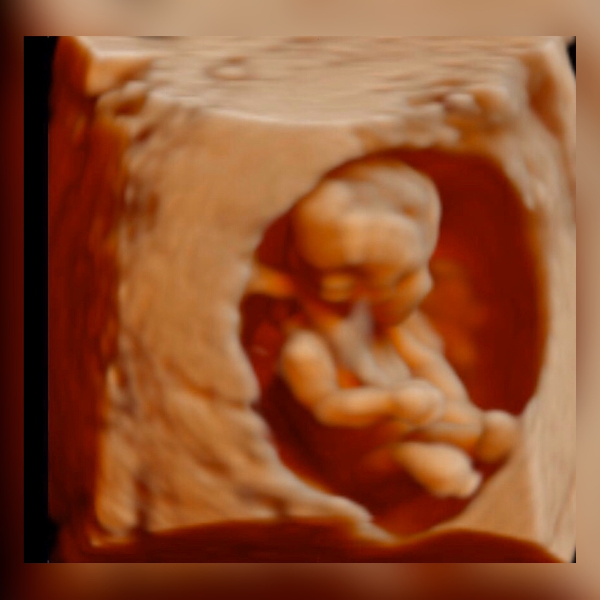 2D, 3D en 4D Pretecho's | Pretecho Vol Verwachting Cuijk, Mill en Uden